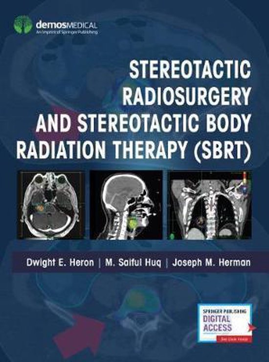 Stereotactic Radiosurgery and Stereotactic Body Radiation Therapy (SBRT) |... | bol.com