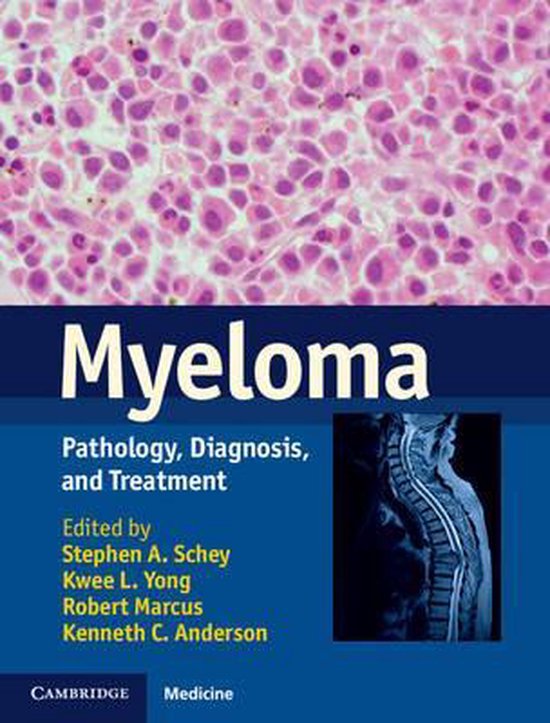 Myeloma | 9781107010574 | Stephen A Schey & Kwee L Yong | Boeken | bol.com