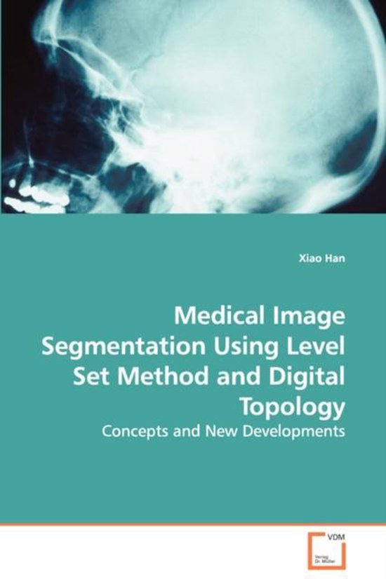 Medical Image Segmentation Using Level Set Method and Digital Topology ...