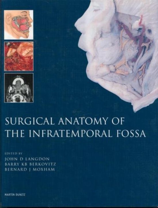 Surgical Management of the Infratemporal Fossa | 9781899066797 | Barry ...
