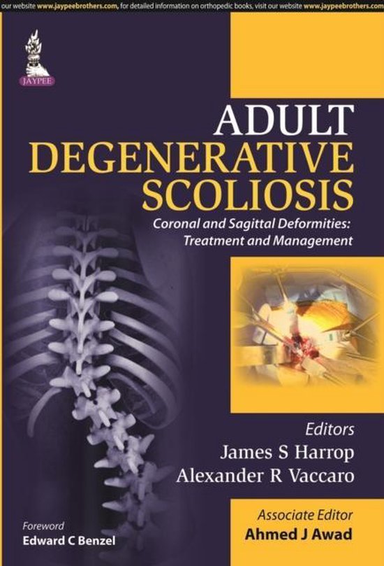 Adult Degenerative Scoliosis | 9789351524960 | James S Harrop | Boeken ...
