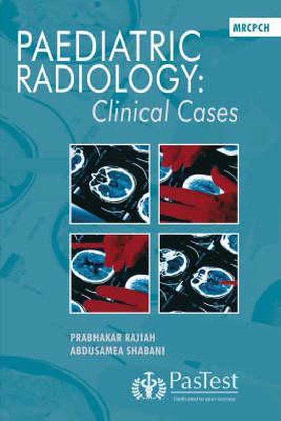 Paediatric Radiology | 9781905635207 | Rajiah Prabhakar | Boeken | bol