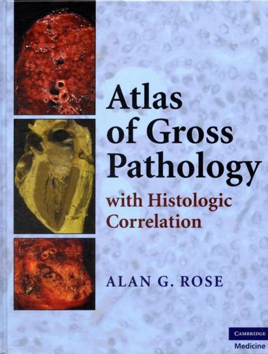 Atlas Of Gross Pathology | 9780521868792 | Alan G. Rose | Boeken | bol.com
