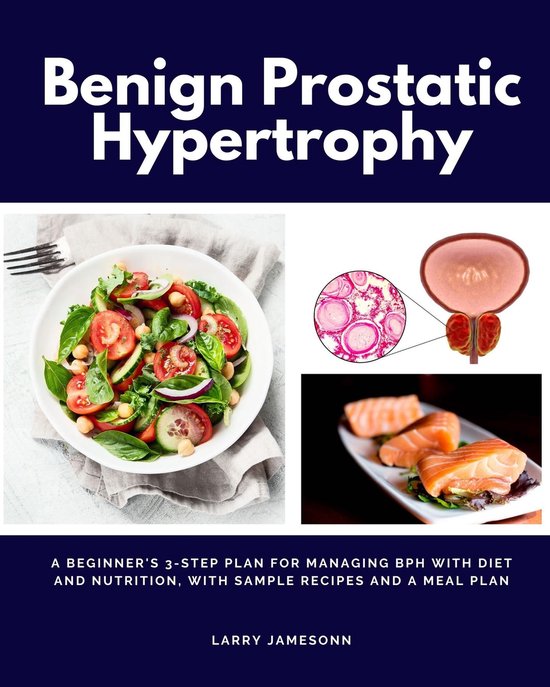 Benign Prostatic Hypertrophy (ebook), Larry Jamesonn | 9798869395962 ...