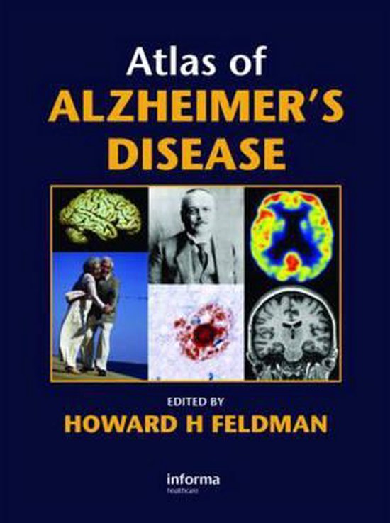 Atlas of Alzheimer's Disease | 9780415390453 | Howard Feldman | Boeken ...
