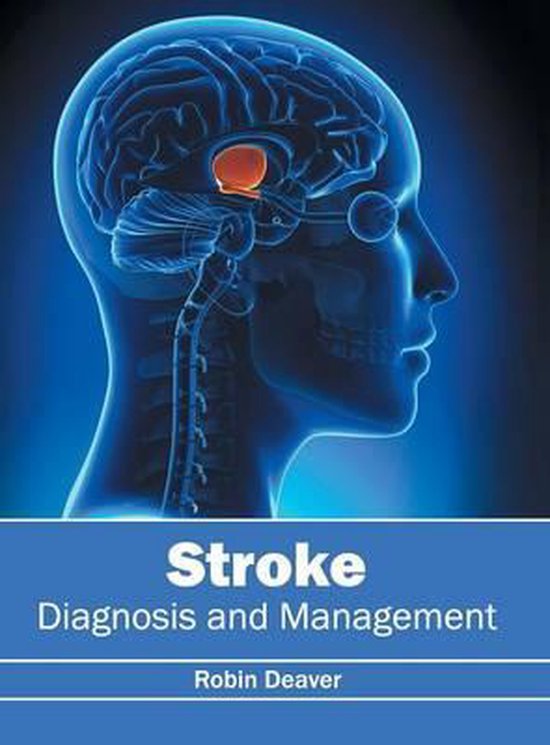 Stroke | 9781632414007 | Boeken | bol.com