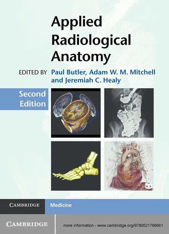 Applied Radiological Anatomy (ebook) | 9781139124294 | Boeken | bol.com