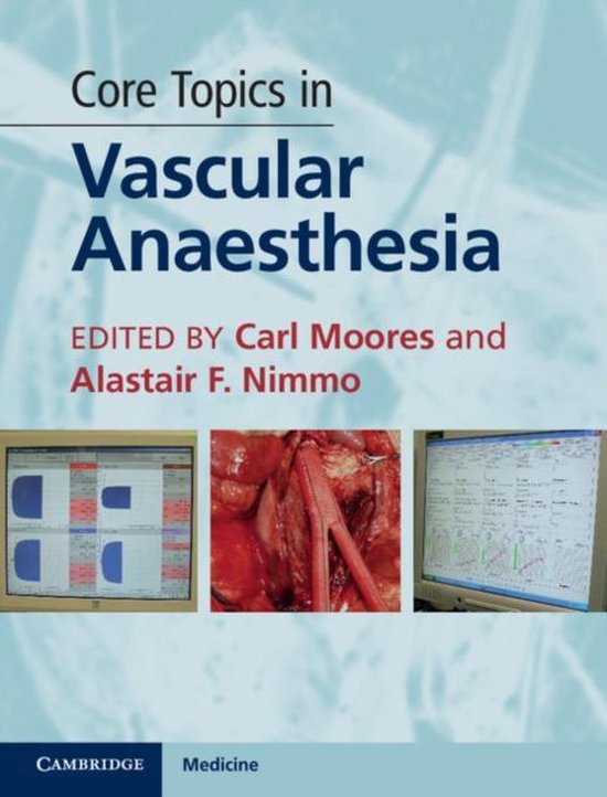Core Topics In Vascular Anesthesia | 9781107001817 | Carl Moores ...