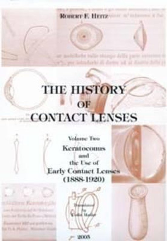 History of Contact Lenses, R. F. Heitz | 9789062993017 | Boeken | bol
