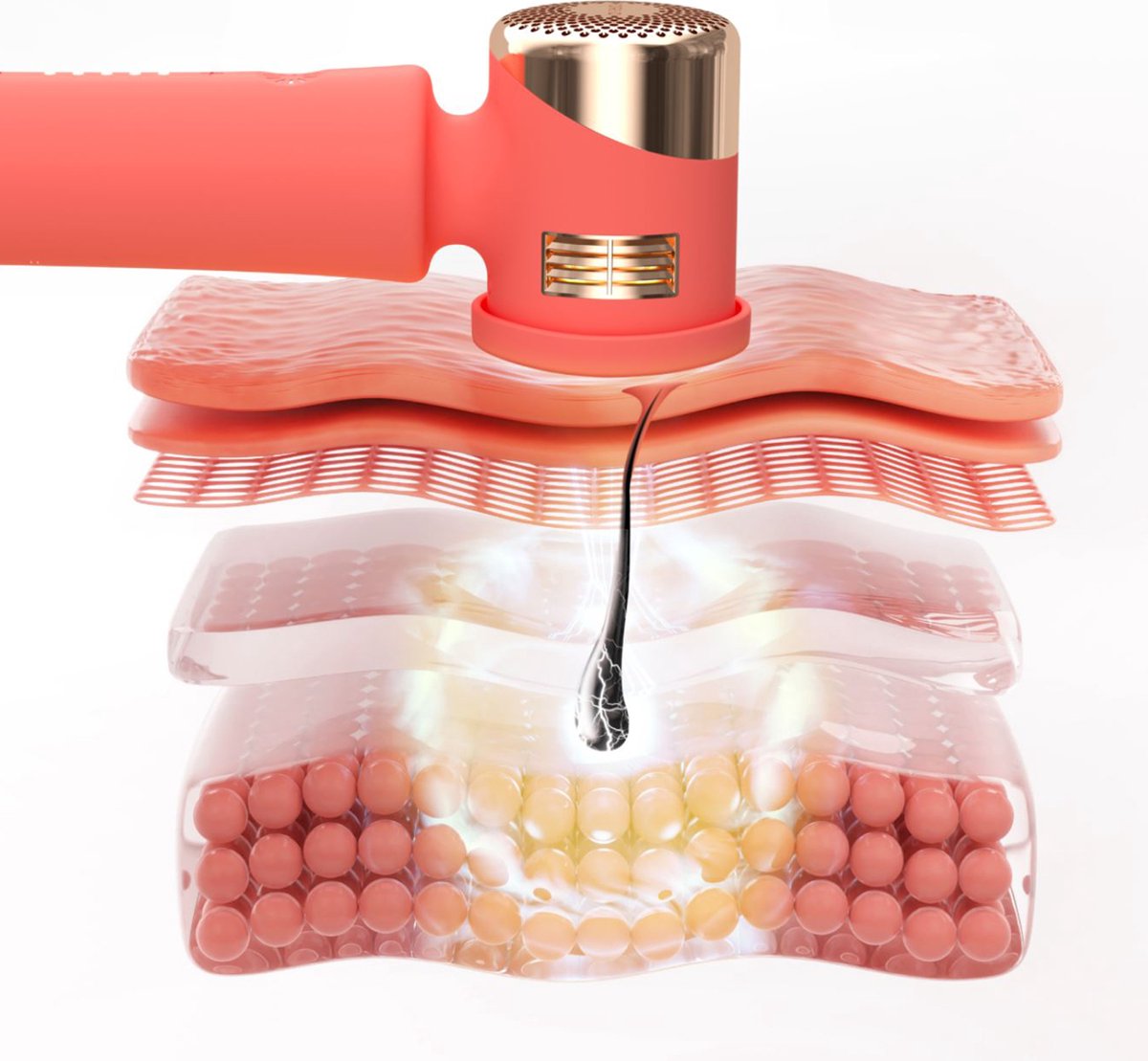 FOREO PEACH™ 2 – IPL-apparaat voor permanente ontharing met Skin ...