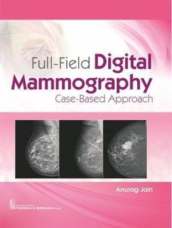 Full-Field Digital Mammography, Anurag Jain | 9789389396270 | Boeken | bol.com