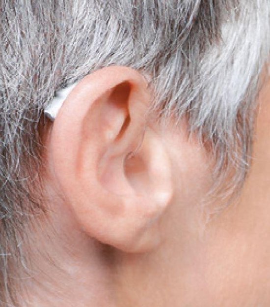 Signia Motion 13 3Nx - | bol.com