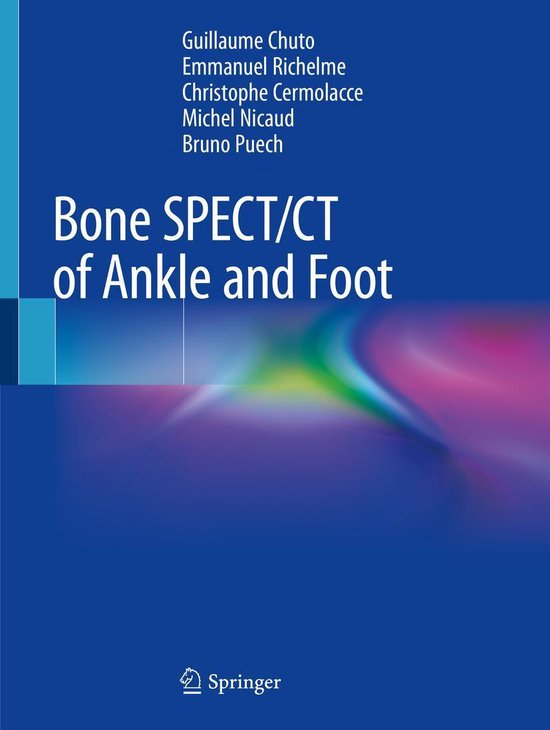 Bone SPECT/CT of Ankle and Foot (ebook), Emmanuel Richelme ...