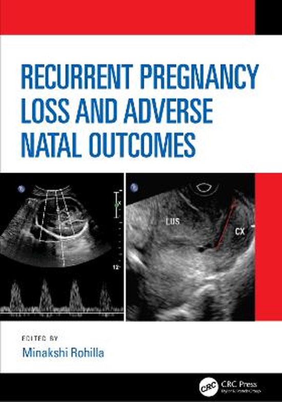 Recurrent Pregnancy Loss And Adverse Natal Outcomes 9781138351820