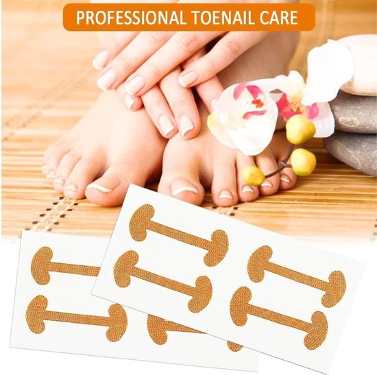 Ingegroeide Teennagel Corrector Stickers - Ademend Elastische Teennagel ...