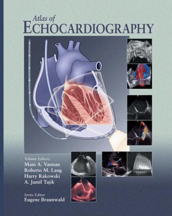 Atlas of Echocardiography | 9781573402170 | Boeken | bol