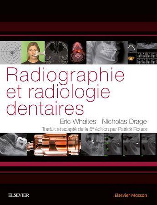 Radiographie et radiologie dentaires campus (ebook), Nicholas Drage ...