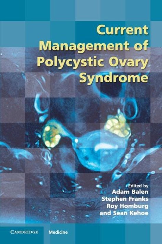 Current Management Of Polycystic Ovary Syndrome | 9781906985417 | Adam ...