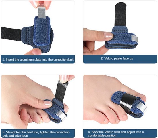 Teenbrace - Teenspalk voor kleine teen - Teen corrector - Vinger spalk ...