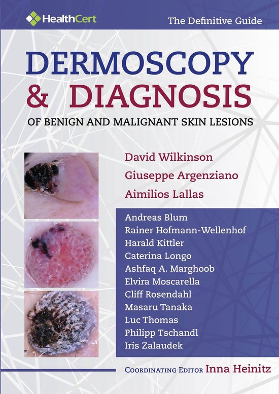 Dermoscopy and Diagnosis of Benign and Malignant Skin Lesions (ebook ...