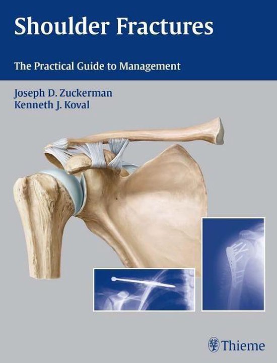 Shoulder Fractures (ebook), Kenneth J. Koval | 9781604065398 | Boeken ...