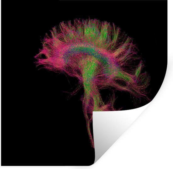 Muurstickers - Sticker Folie - MRI scan - 120x120 cm - Plakfolie ...
