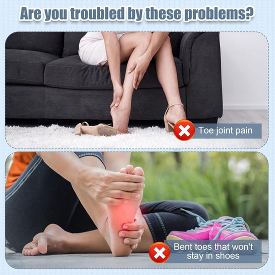 12pcs Hammer Toe Straightener - Toe Corrector - Big Toe - Toe Splint ...