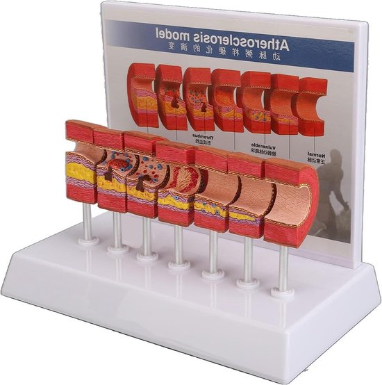 Allecto Plus - Anatomie Model Menselijk Lichaam Slagader Model ...