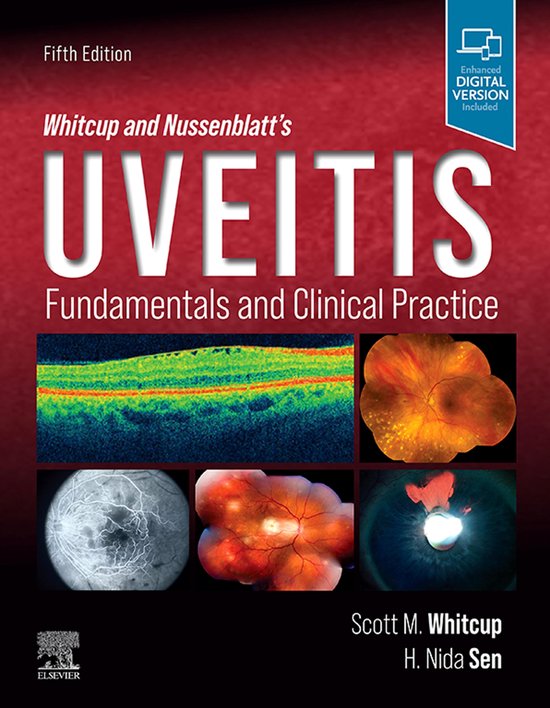 Whitcup and Nussenblatt's Uveitis (ebook), Scott M. Whitcup ...