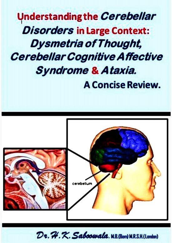 Understanding the Cerebellar Disorders in Large Context: Dysmetria of ...