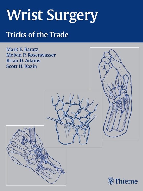 Wrist Surgery (ebook), Mark E. Baratz | 9781638530176 | Boeken | bol