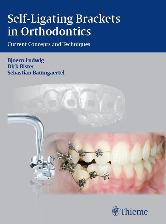 Self-Ligating Brackets in Orthodontics (ebook), Dirk Bister | 9783132579132 | Boeken | bol