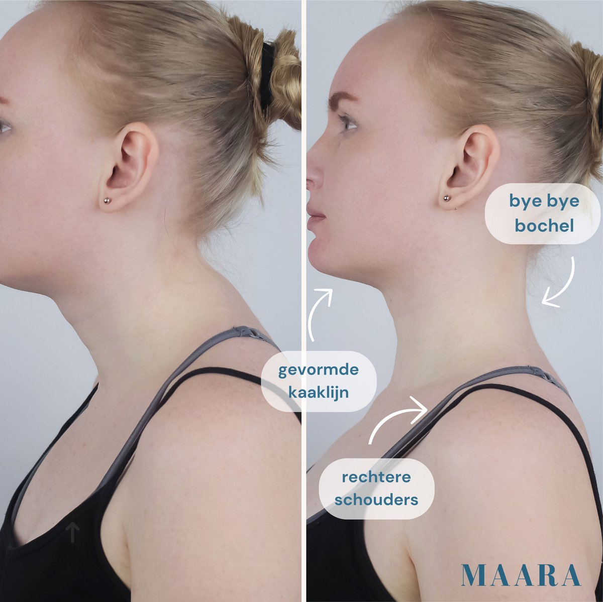 Nekstretcher met warmte - Neck Cloud - Nekkussen met verwarmde hoes ...