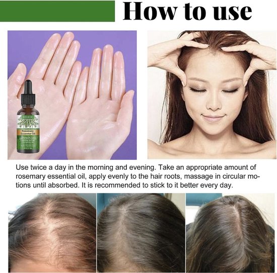 Derma roller 2mm + Rosemary oil 30ml set - Haargroei - Baardgroei kit ...