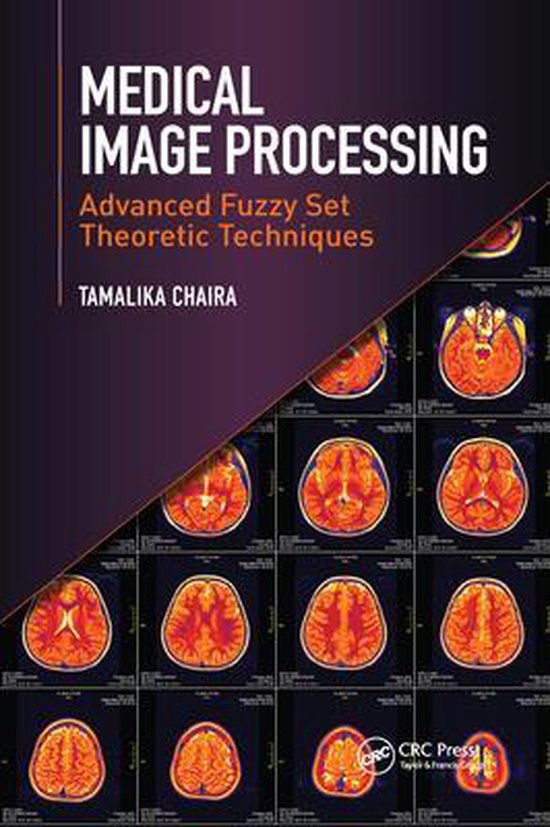 Medical Image Processing | 9780367575960 | Tamalika Chaira | Boeken | bol
