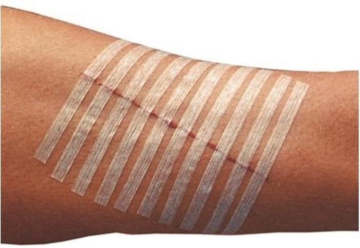 Relistrip hechtstrips - wondhechting - Steriel - 2 x 5 stuks | bol.com