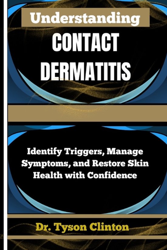 Understanding Contact Dermatitis, Tyson Clinton | 9798265672353 ...
