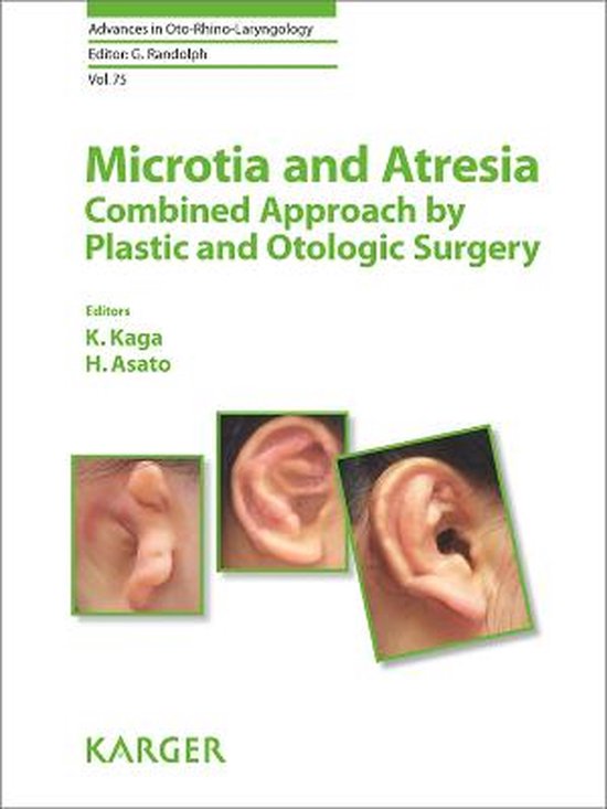 Microtia and Atresia - Combined Approach by Plastic and Otologic ...