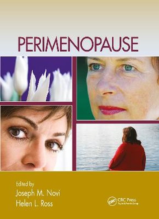 Perimenopause | 9780824754495 | Kiperstzok | Boeken | bol.com