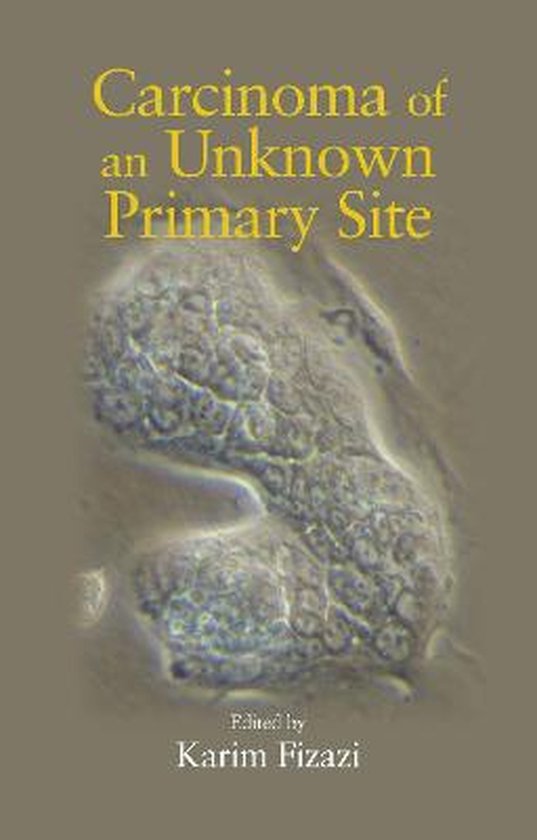 Carcinoma of an Unknown Primary Site | 9780824727994 | Karim Fizazi ...