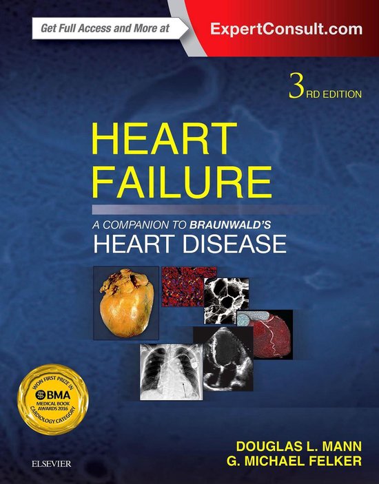 Heart Failure E-Book (ebook), Douglas L. Mann, Md | 9780323315685 ...