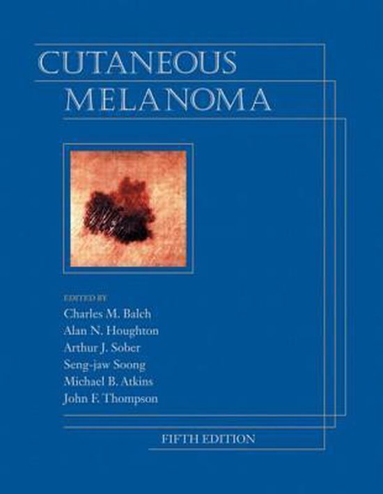 Cutaneous Melanoma, Fifth Edition | 9781576262764 | Balch, Charles M ...