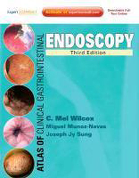 Atlas Of Clinical Gastrointestinal Endoscopy | 9781437719093 | Charles ...