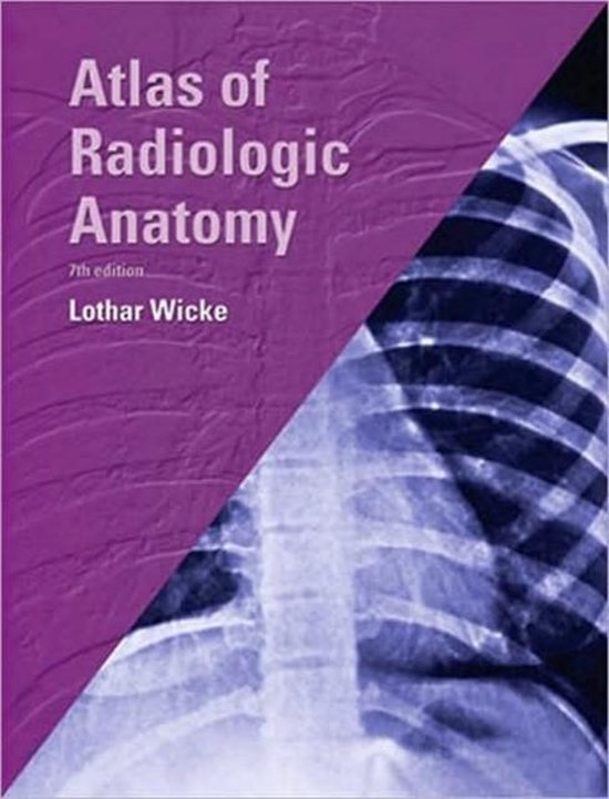 Atlas of Radiologic Anatomy | 9781929007462 | Lothar Wicke | Boeken | bol