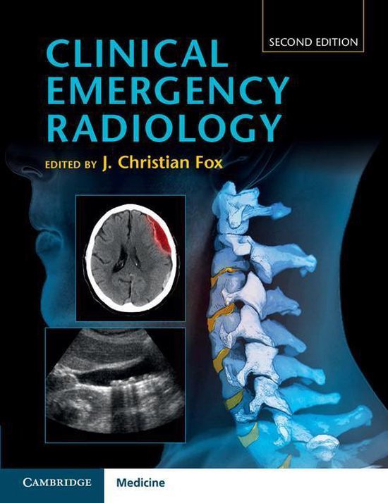 Clinical Emergency Radiology (ebook) | 9781316588635 | Boeken | bol