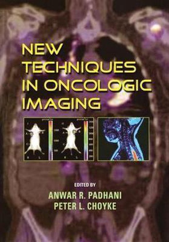 New Techniques in Oncologic Imaging | 9780849392740 | Padhani R ...