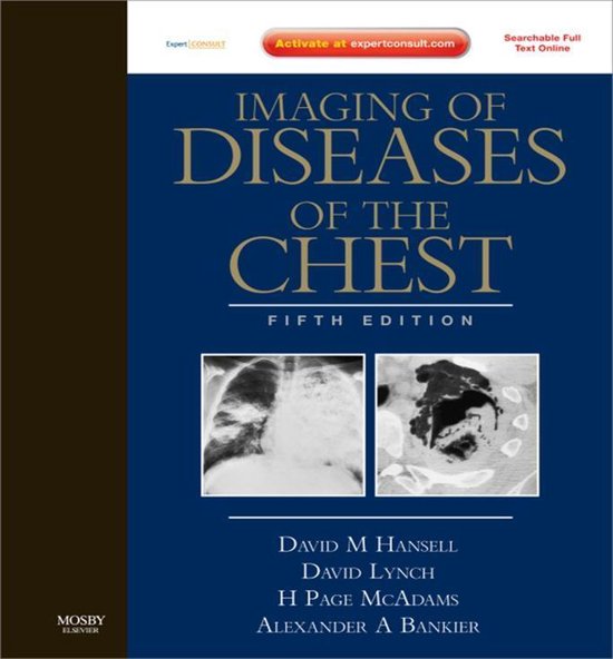 Imaging of Diseases of the Chest E-Book (ebook), David M. Hansell ...