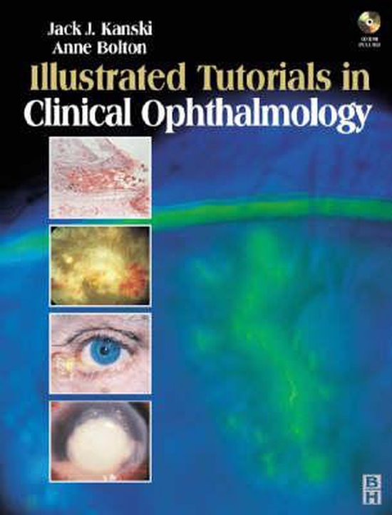Illustrated Tutorials in Clinical Ophthalmology with CD-ROM, Jack J ...