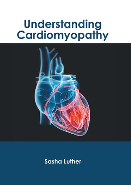 Understanding Cardiomyopathy 9781632429292 Boeken