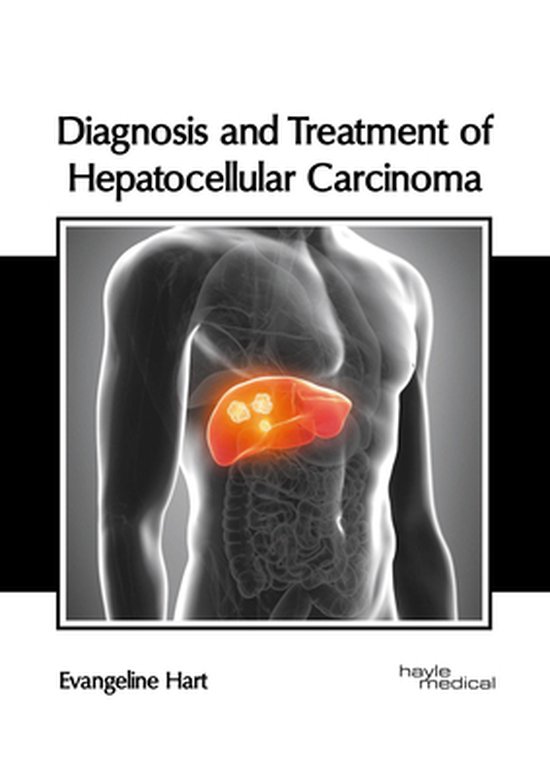 Diagnosis and Treatment of Hepatocellular Carcinoma | 9781632418517 ...